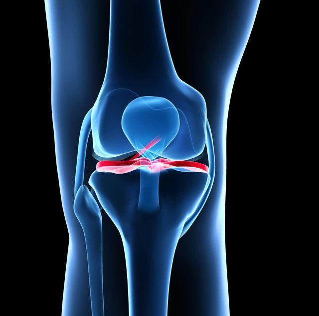 The Infamous Pop: How to Find Effective Treatment for ACL Tear ...