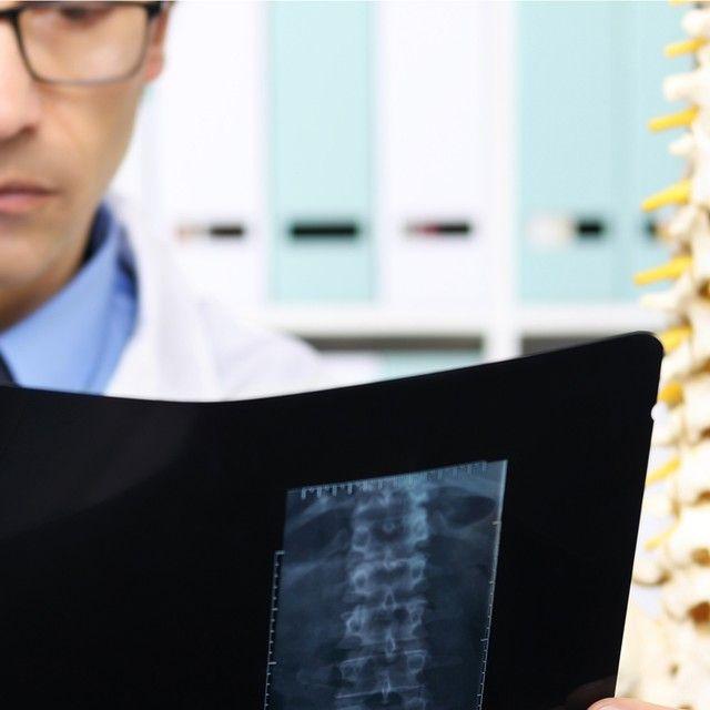 Is Spinal Reconstructive Surgery for Deformities the Right Treatment ...