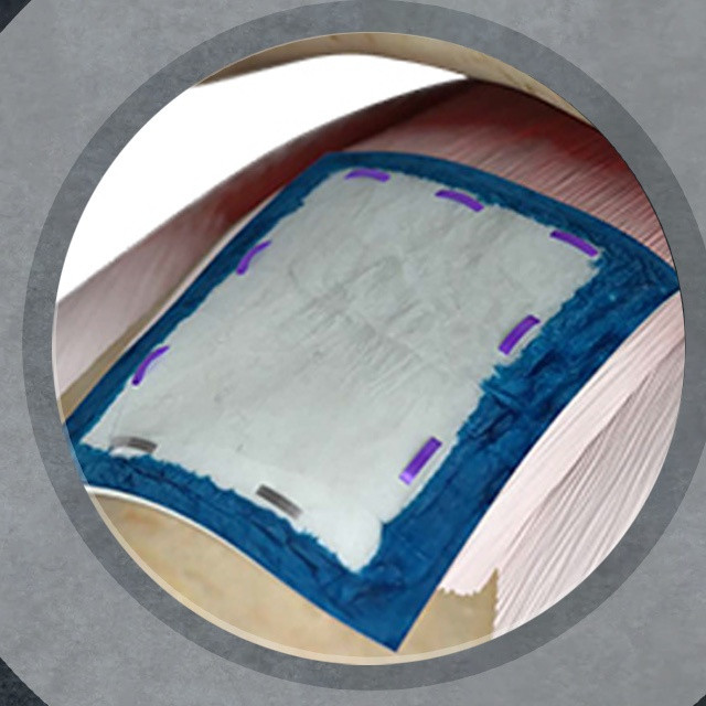 Treating Rotator Cuff Tears Using the Regenten Patch | Rothman ...