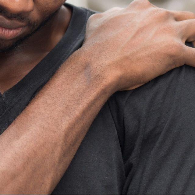 The Four Steps of Rotator Cuff Tear Treatment in Montvale | Rothman ...