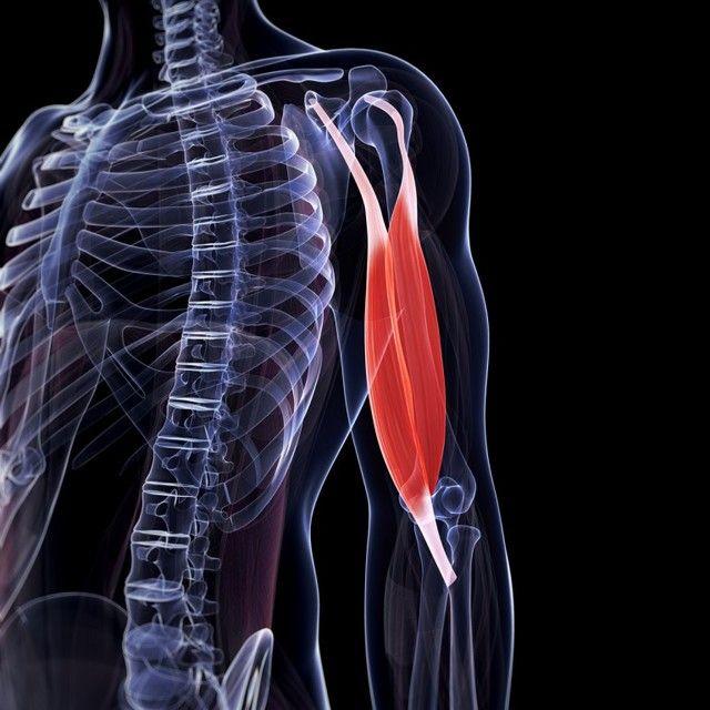 Get the Facts: Biceps Tendon Rupture | Rothman Orthopaedic Institute